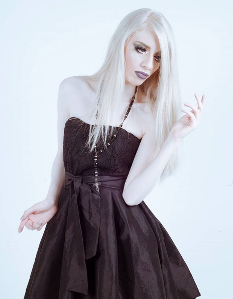 I 5 albini più famosi al mondo - Nero Su Bianco